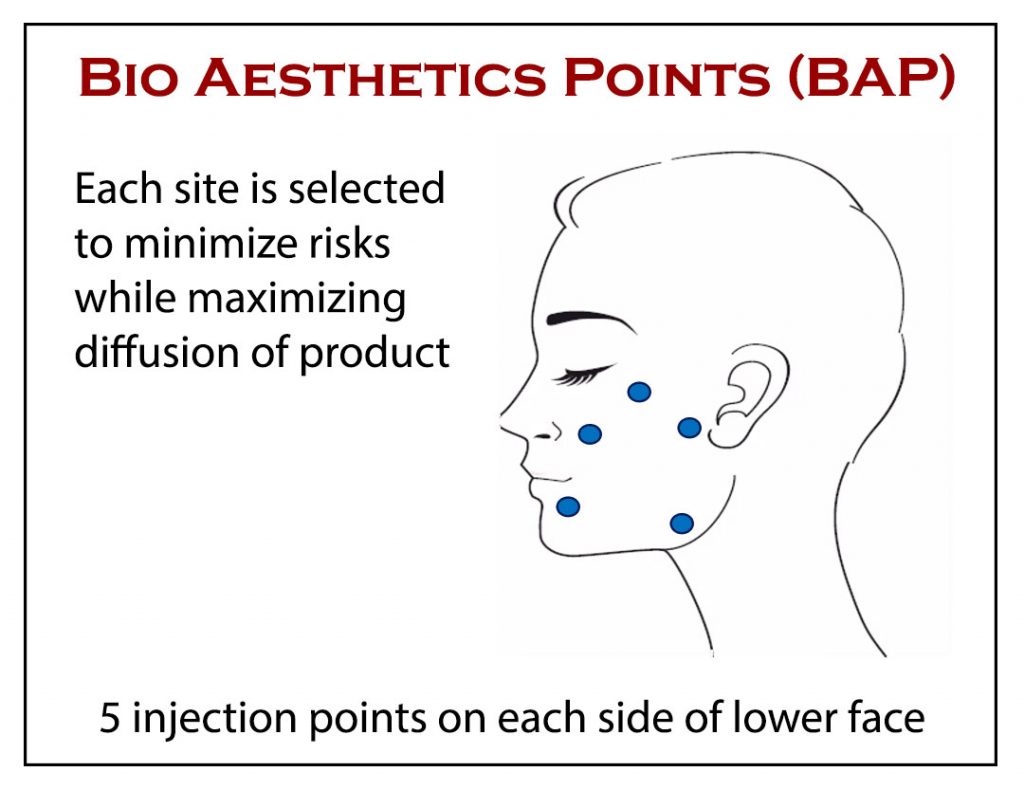 HA Biostimulator Singapore - Arium Clinic | Medical Aesthetics