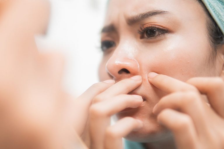 What is Pimple Injection? - Arium Clinic | Medical Aesthetics