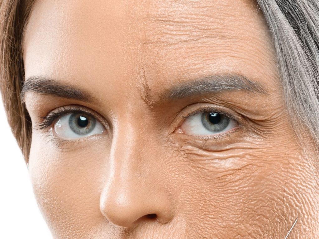 Keeping our eyes young - Arium Clinic | Medical Aesthetics